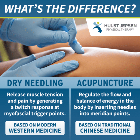 Dry Needling | Hulst Jepsen